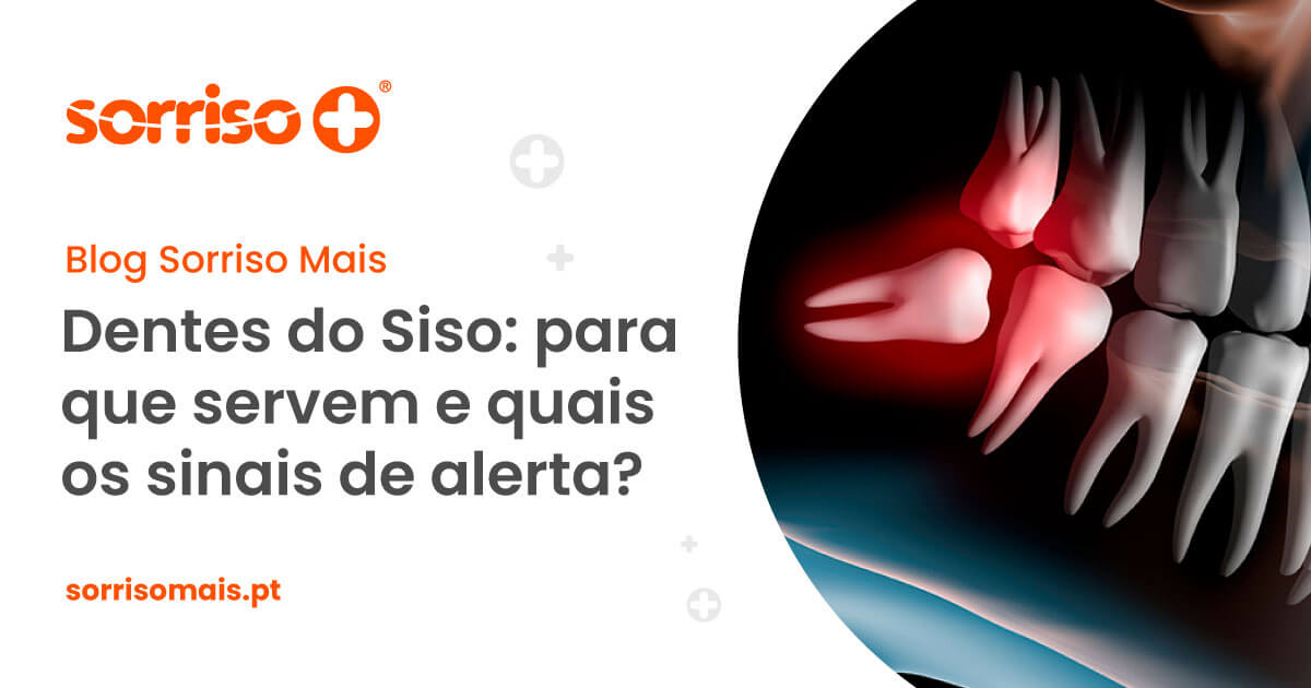 Dentes do Siso: para que servem e quais os sinais de alerta?