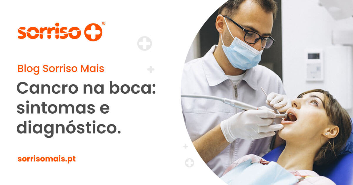 Cancro na boca: sintomas e diagnóstico - Sorriso Mais