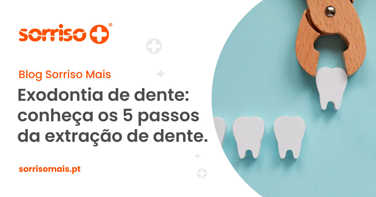 Exodontia de dente: conheça os 5 passos da extração de dente