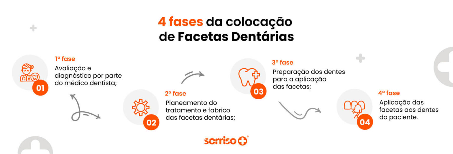 Facetas Dentárias - Plano Dental Sorriso Mais