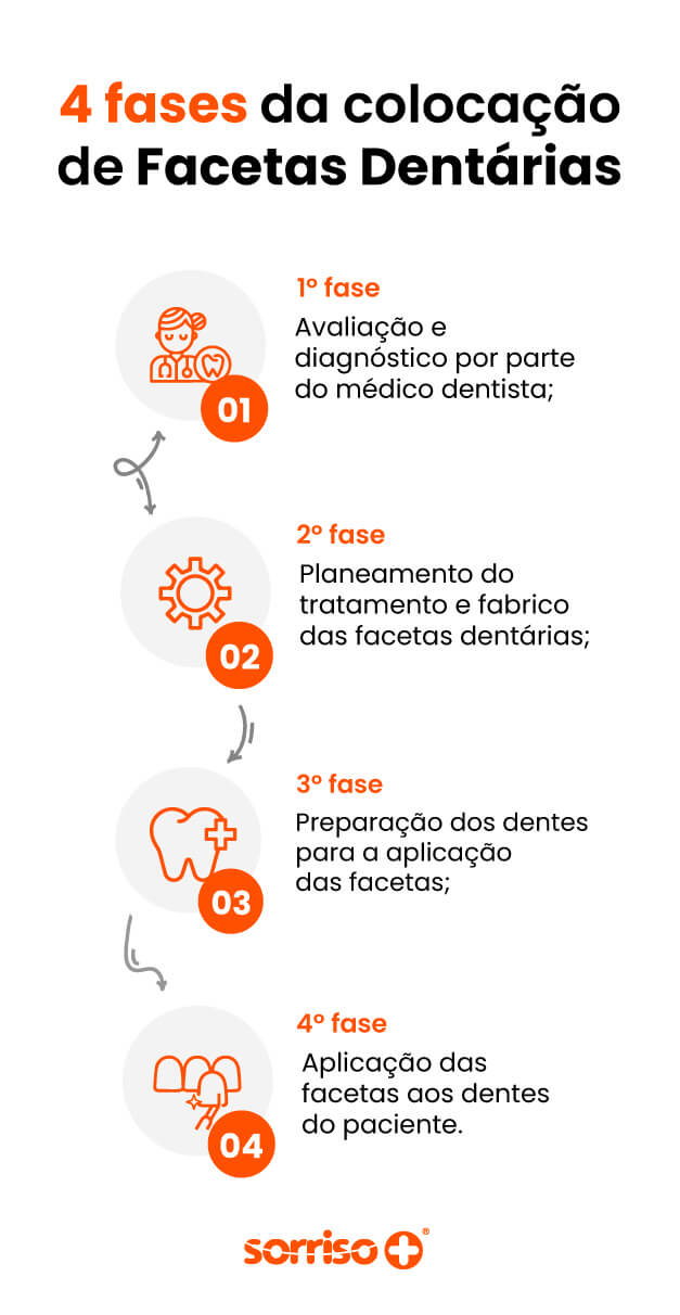 Facetas Dentárias - Plano Dental Sorriso Mais