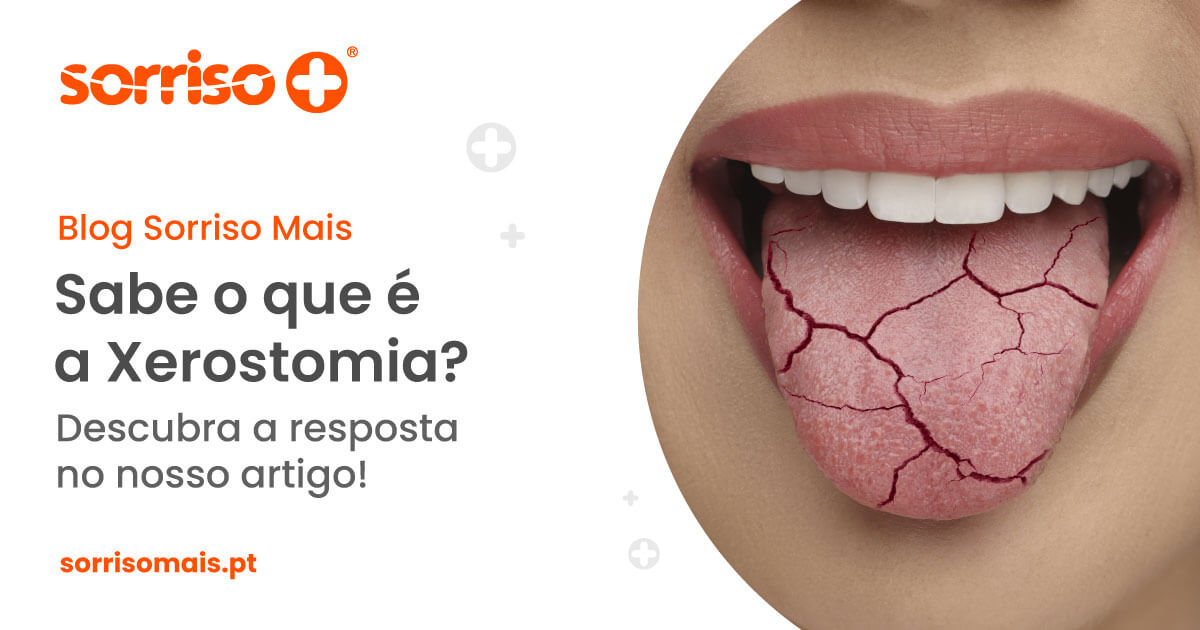 Xerostomia: sabe o que é? - Sorriso Mais
