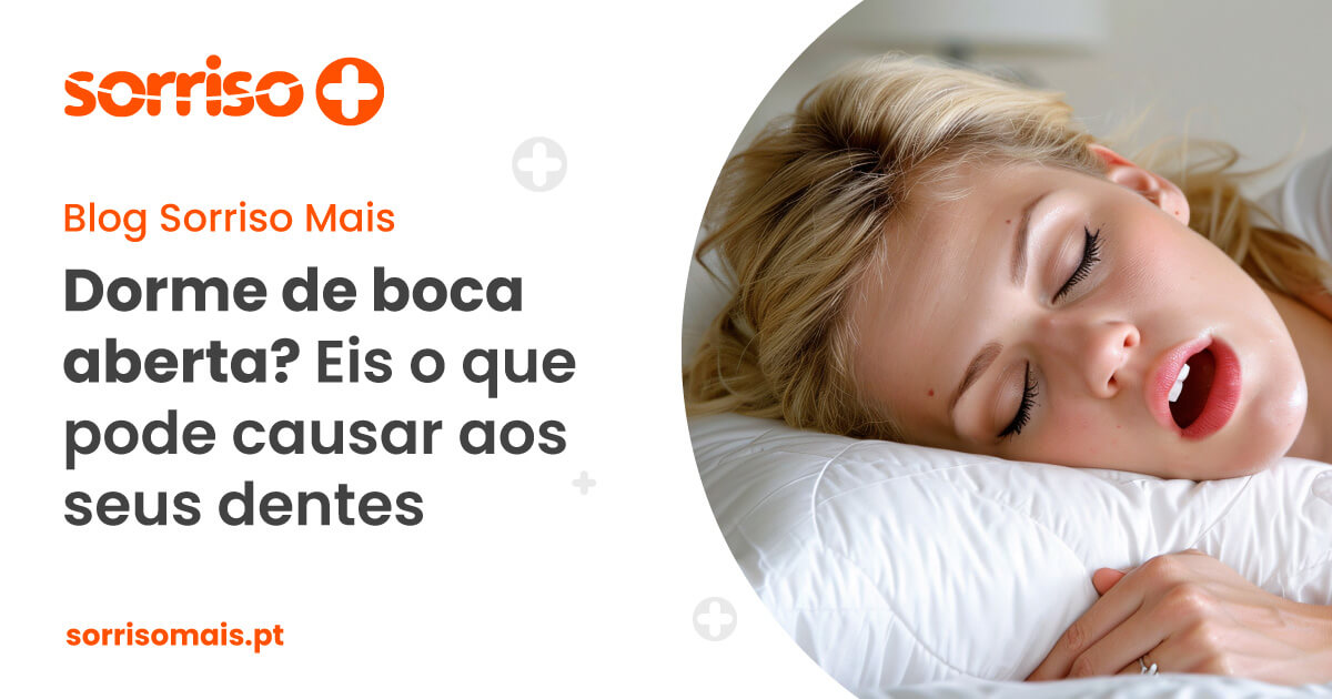 Dorme de boca aberta? Eis o que pode causar aos seus dentes