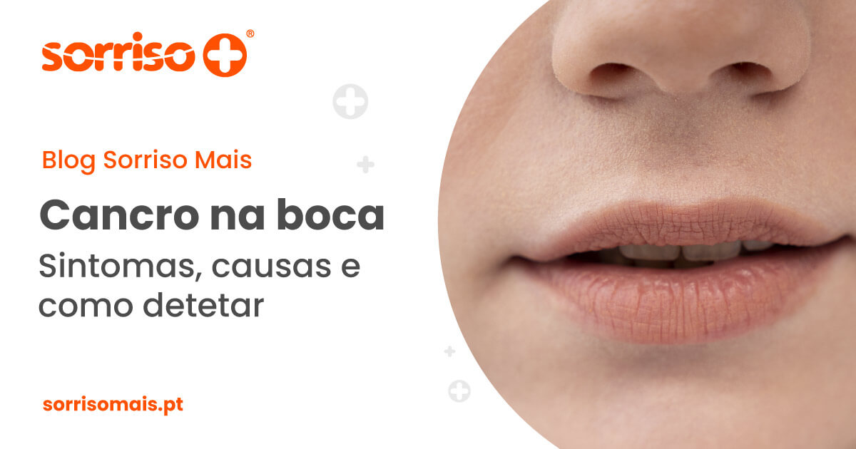 Cancro na boca: sintomas, causas e como detetar precocemente
